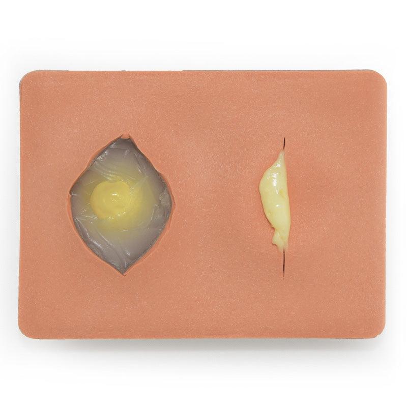 Surgireal, Simuliertes Gewebe mit Zyste und Abszess, helle Haut ...